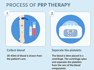 Infographics | Orange County Pain Clinics